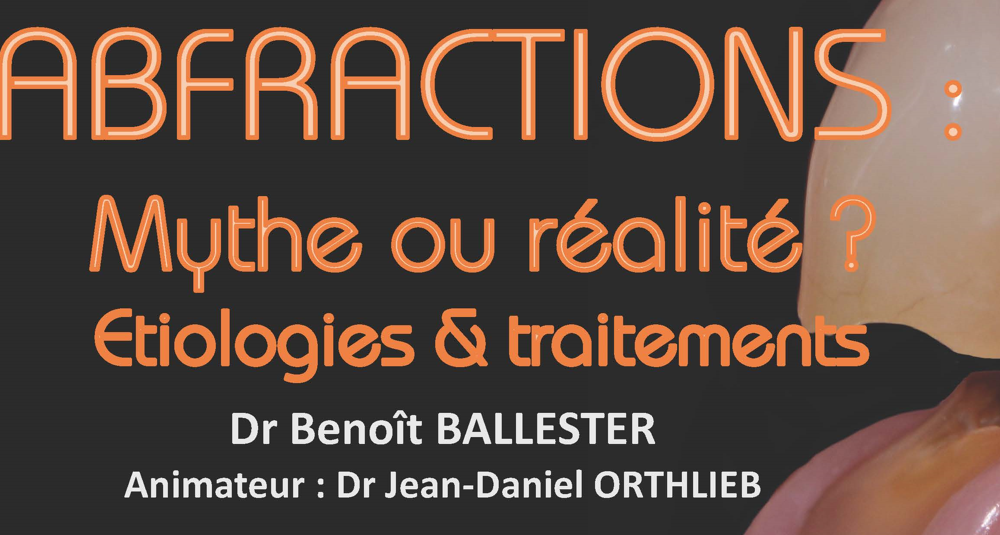 CONFÉRENCE : ABFRACTIONS : mythe ou réalité ? – Collège National d ...